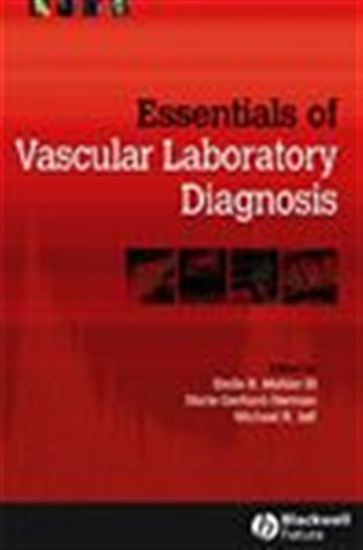 Essentials of Vascular Laboratory Diagnosis | Archambault
